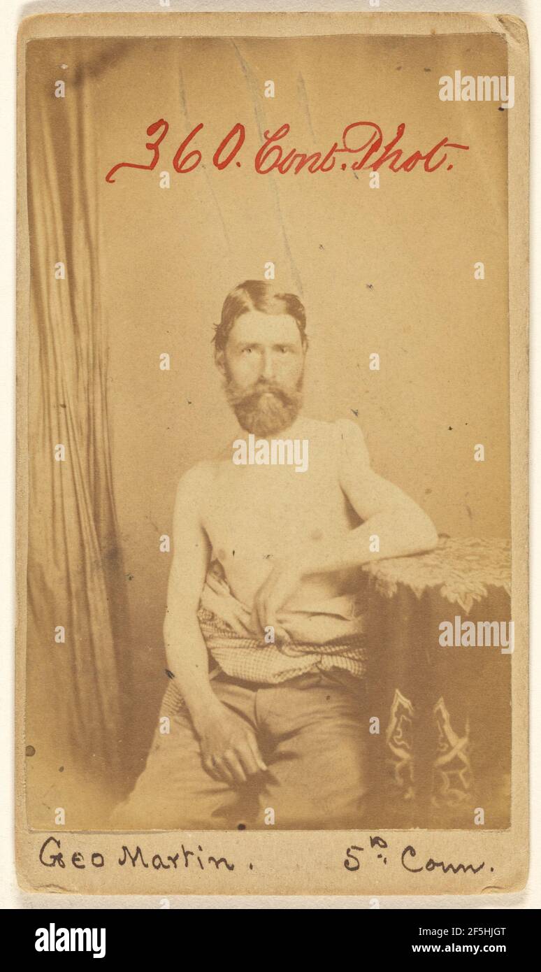 Geo. Martin, 5th Conn. Civil War victim. S. Friedlaender (American ...