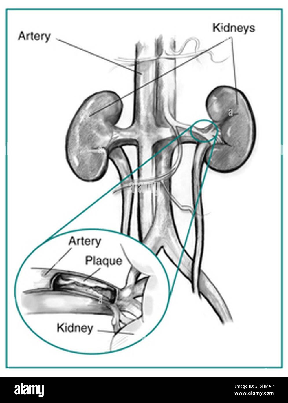 Ras Cut Out Stock Images & Pictures - Alamy