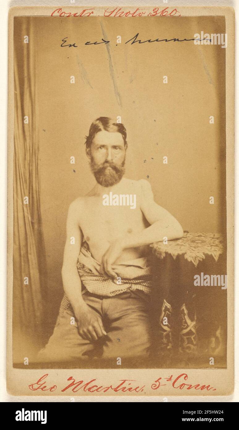 Geo. Martin, 5d Conn. Civil War victim. S. Friedlaender (American ...