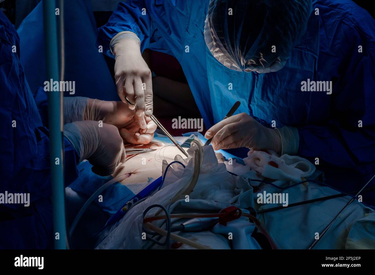 Doctors use medical instruments and metal thread to suture human skin ...