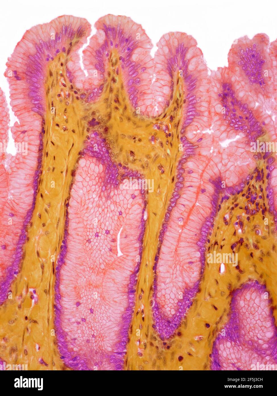 Stomach surface microscope hi-res stock photography and images - Alamy