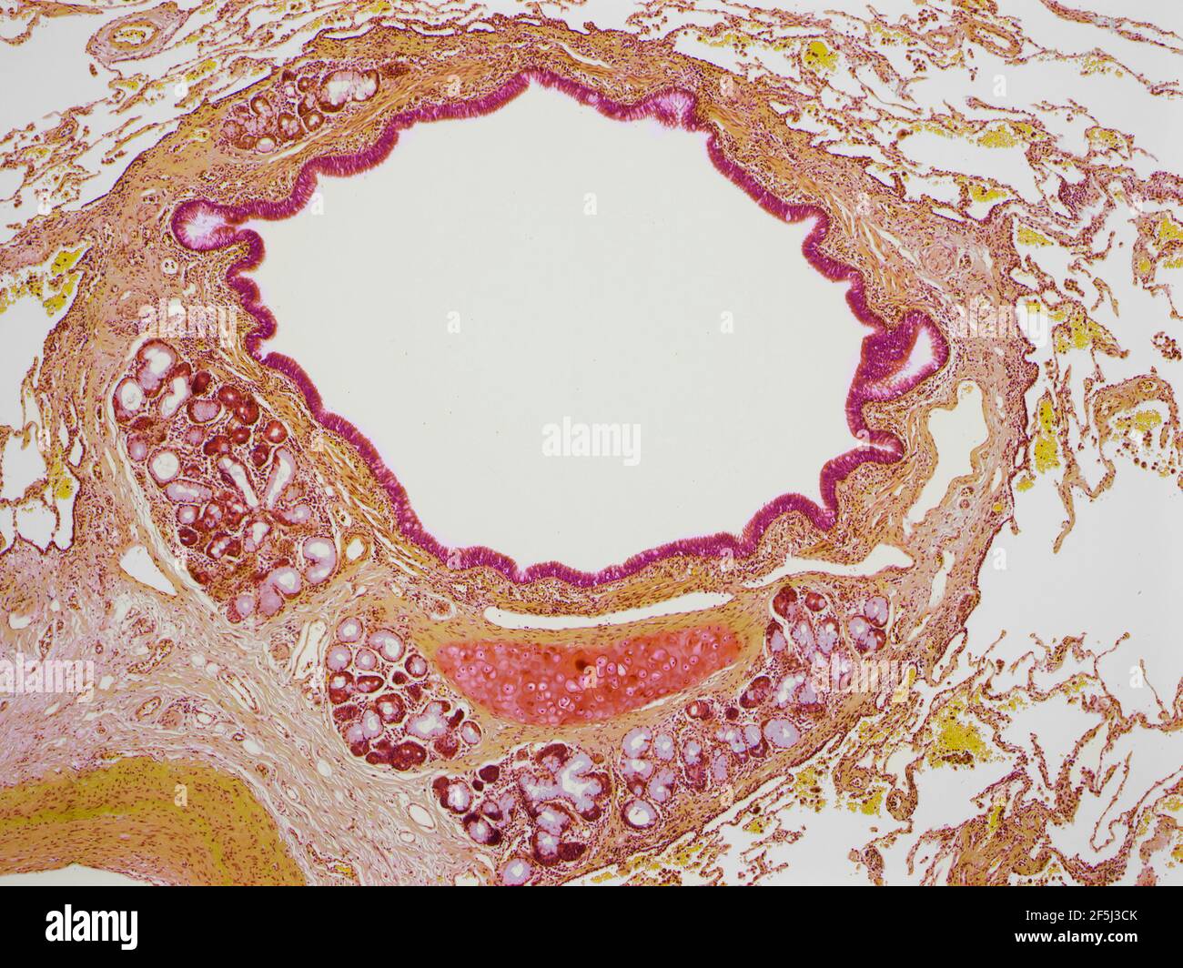 Human lung anatomy and histology hi-res stock photography and images ...