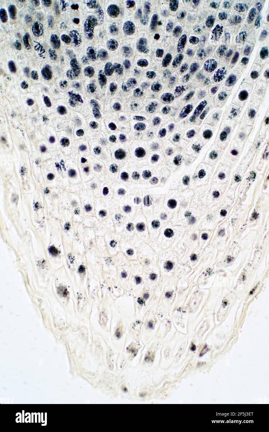 Mitosis, light micrograph Stock Photo - Alamy