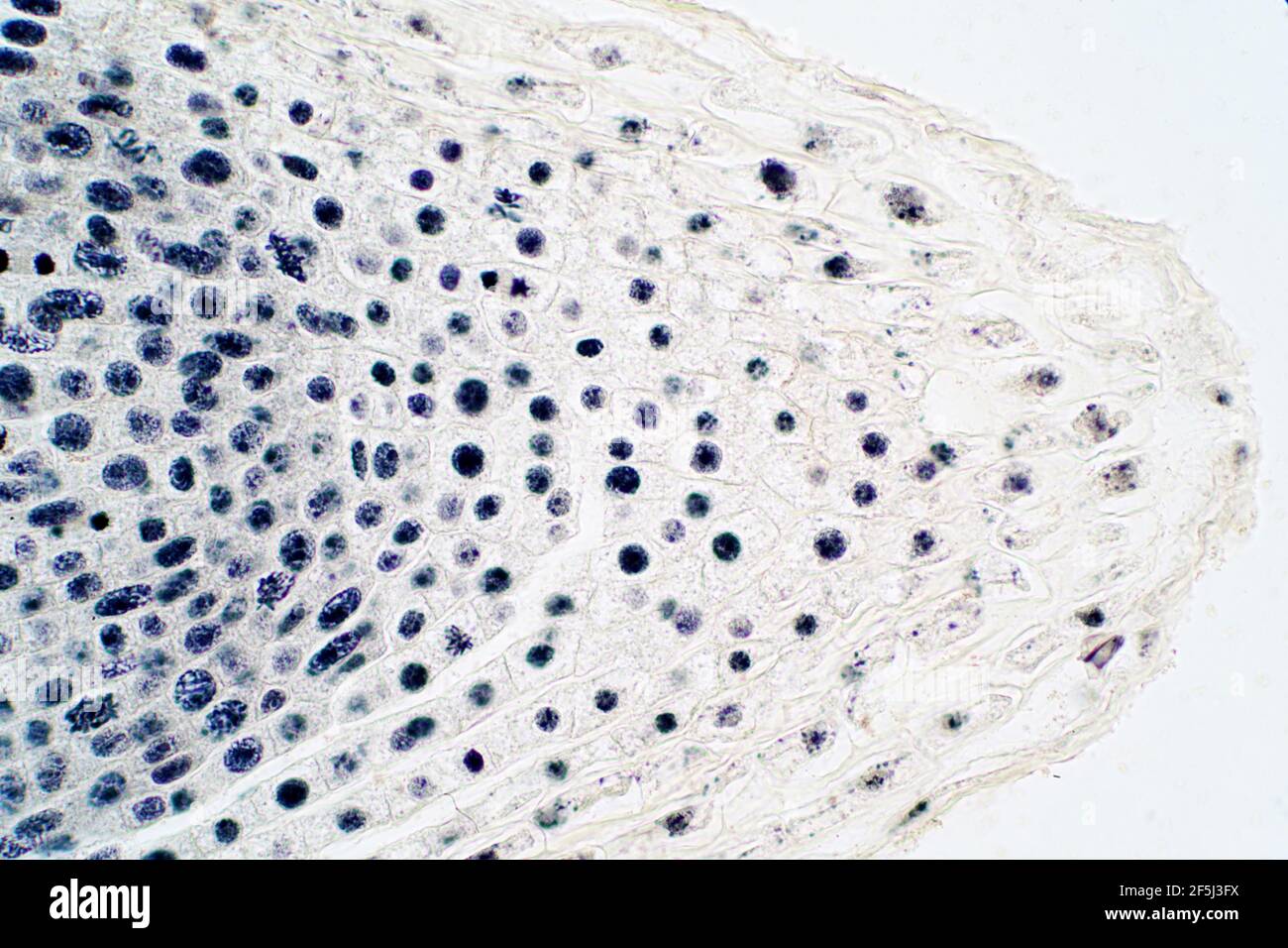 Mitosis, light micrograph Stock Photo - Alamy