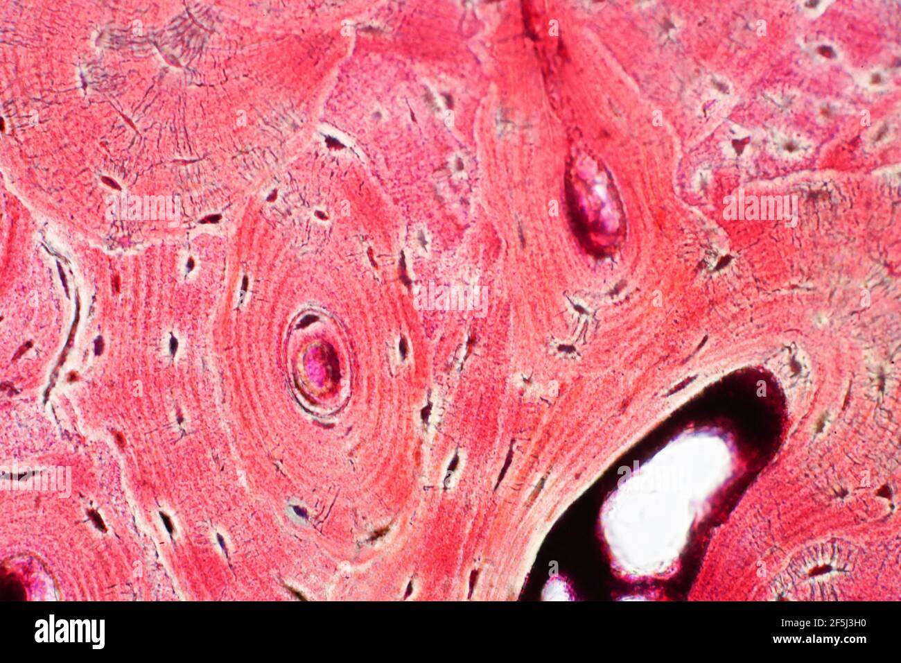 Compact bone micrograph hi-res stock photography and images - Alamy