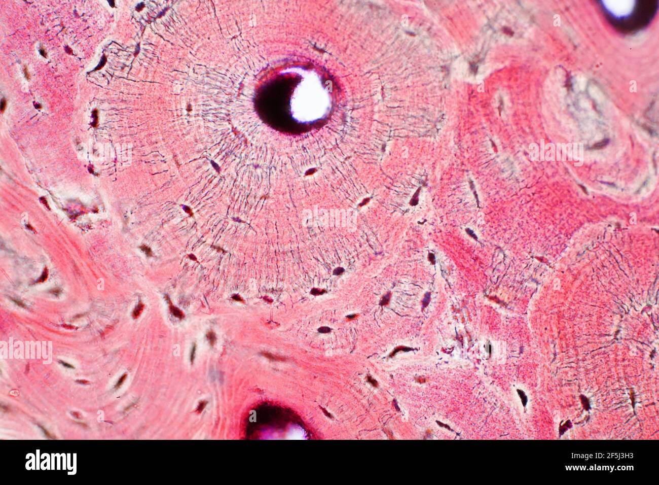Human compact bone, light micrograph Stock Photo - Alamy