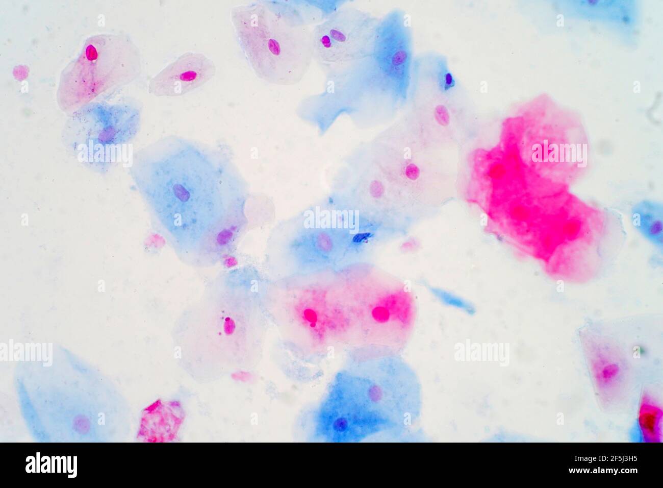 Squamous Epithelial Cells Under Microscope