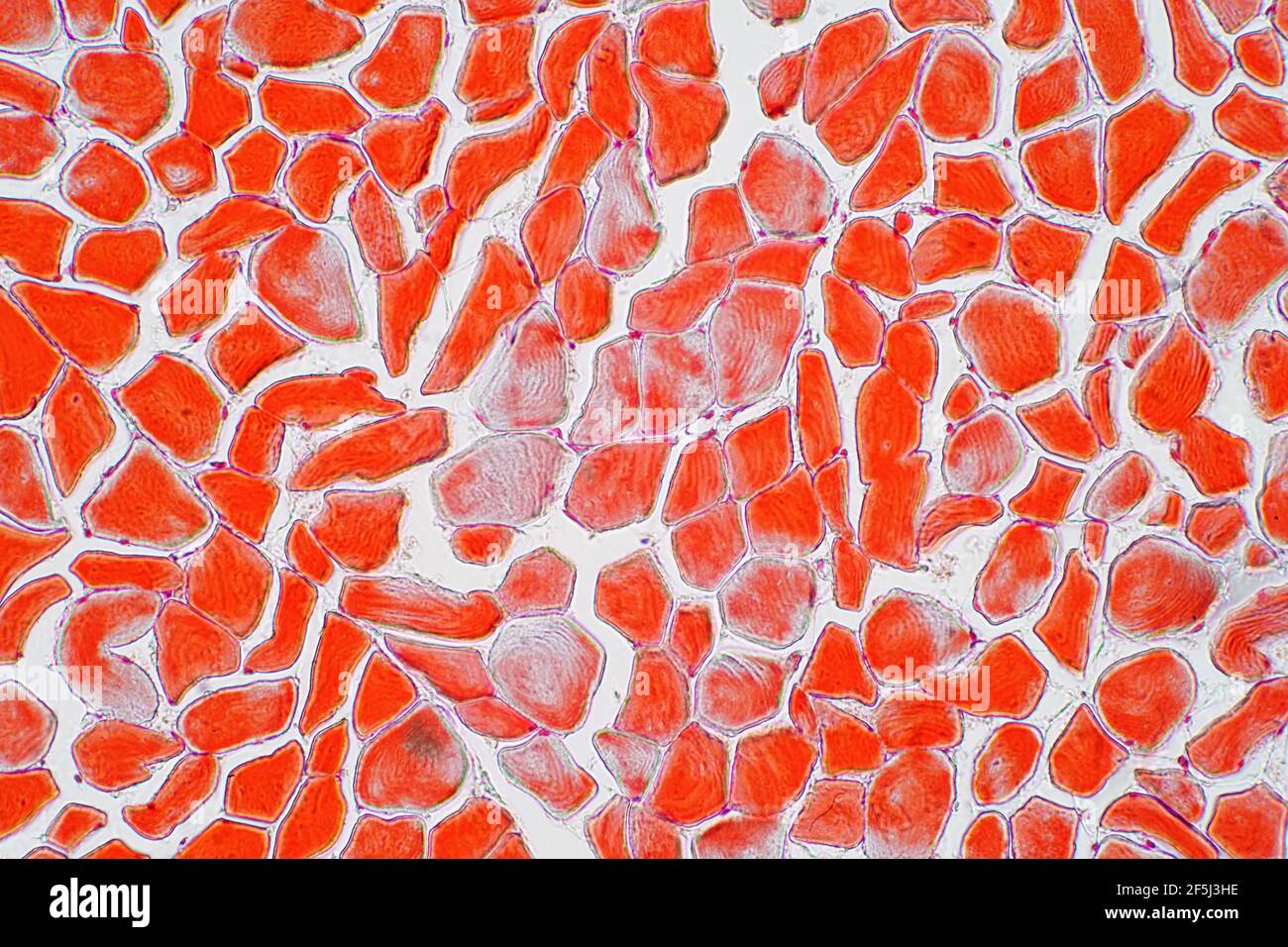 Skeletal muscle fibres light micrograph hi-res stock photography and ... Skeletal muscle fibres light micrograph hi-res stock photography and ...