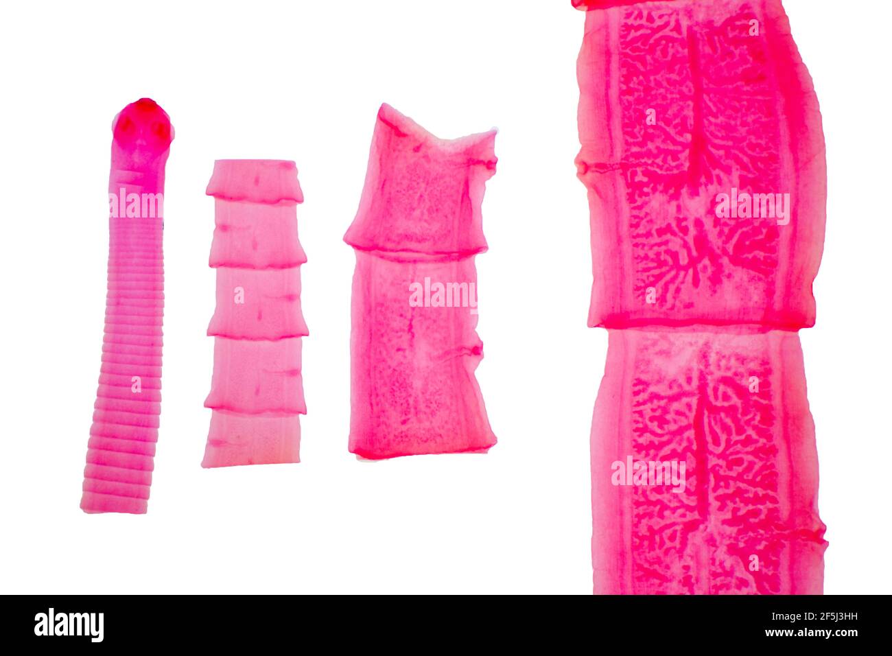 Tapeworm Under A Microscope