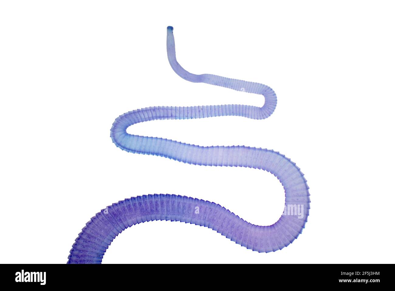 Beef tapeworm hi-res stock photography and images - Alamy