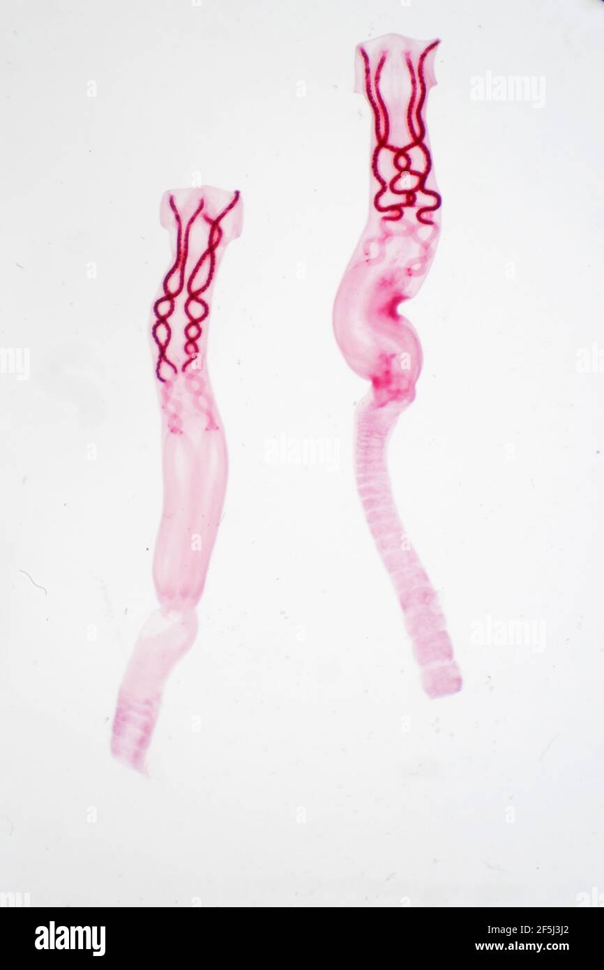 Tapeworm microscope hi-res stock photography and images - Alamy