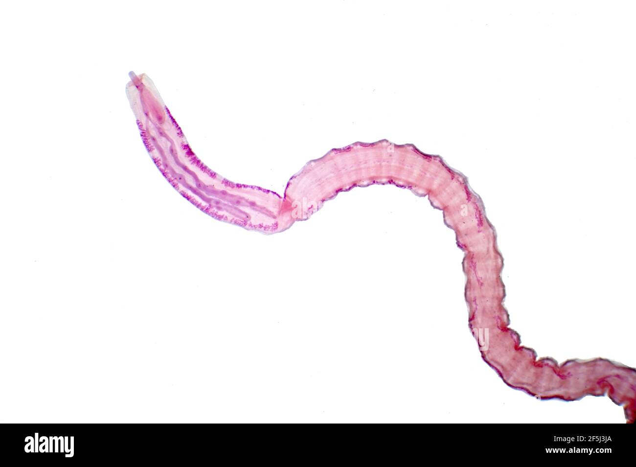 Beef Tapeworm High Resolution Stock Photography and Images - Alamy