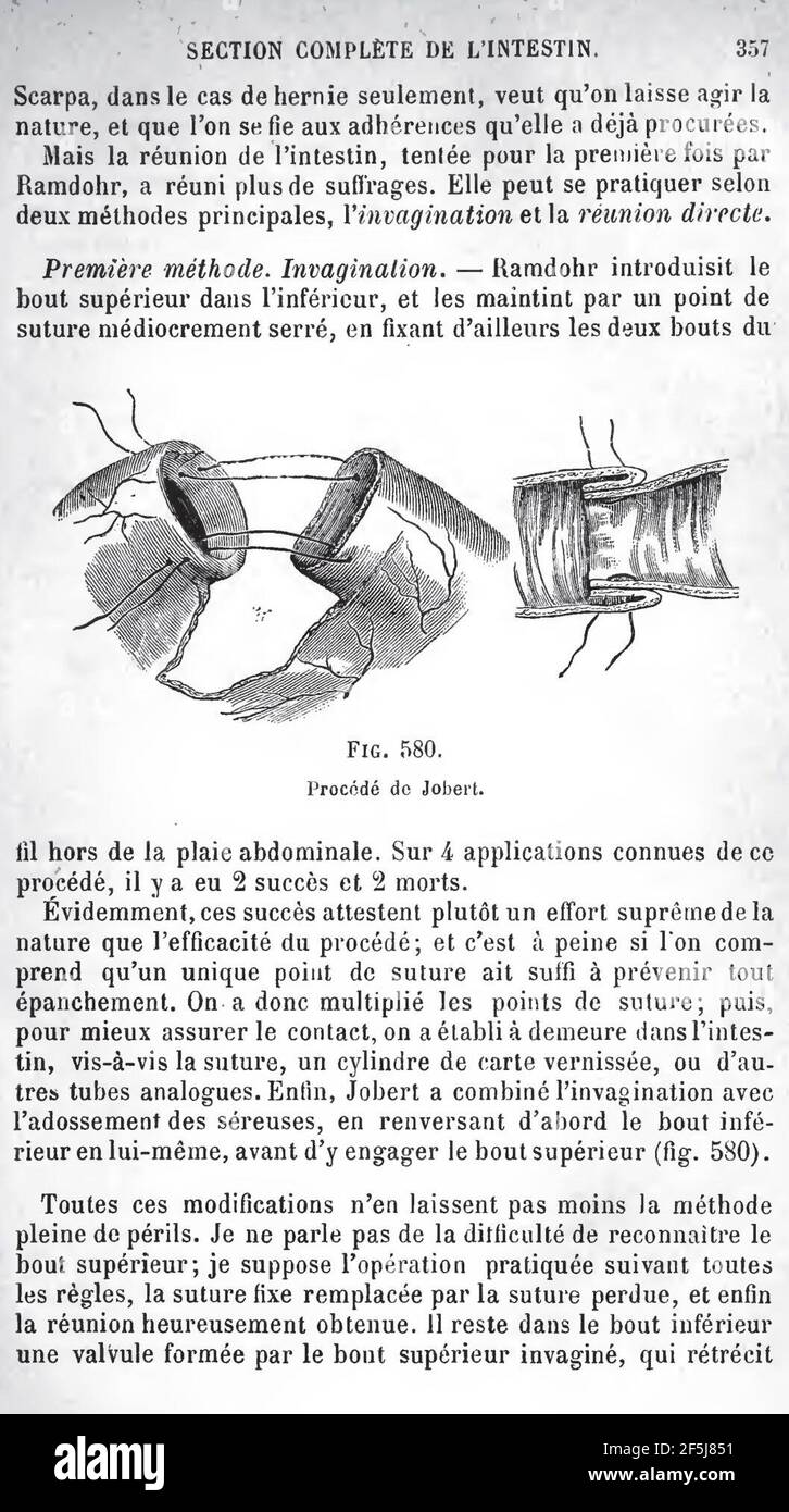 Naht hi-res stock photography and images - Alamy