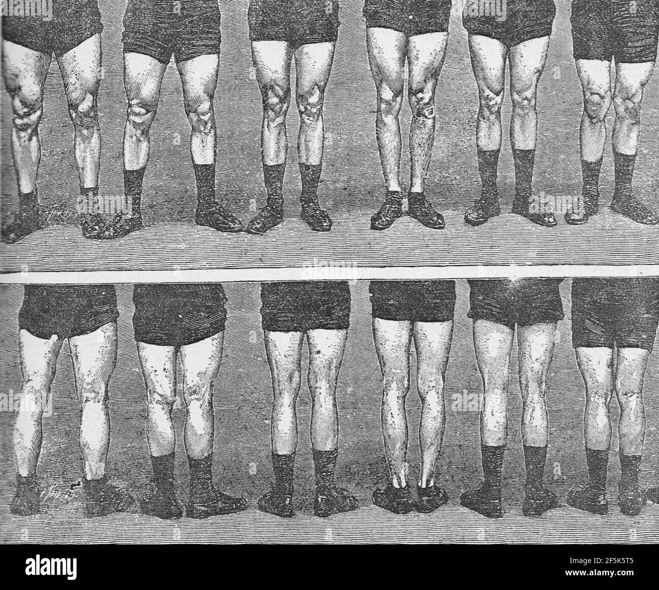 Beine Black and White Stock Photos & Images - Alamy