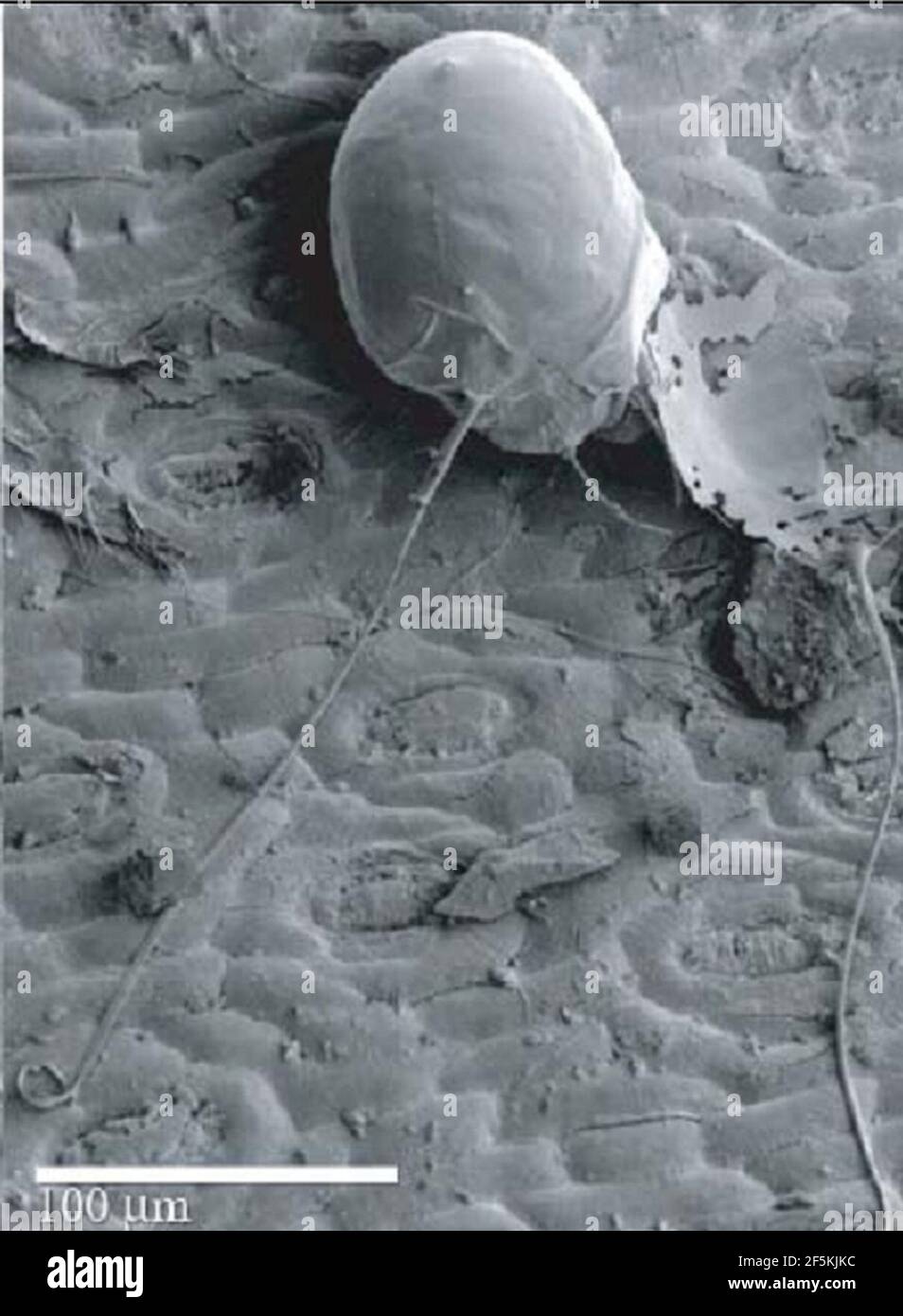 Raoiella indica - red palm mite egg Stock Photo - Alamy