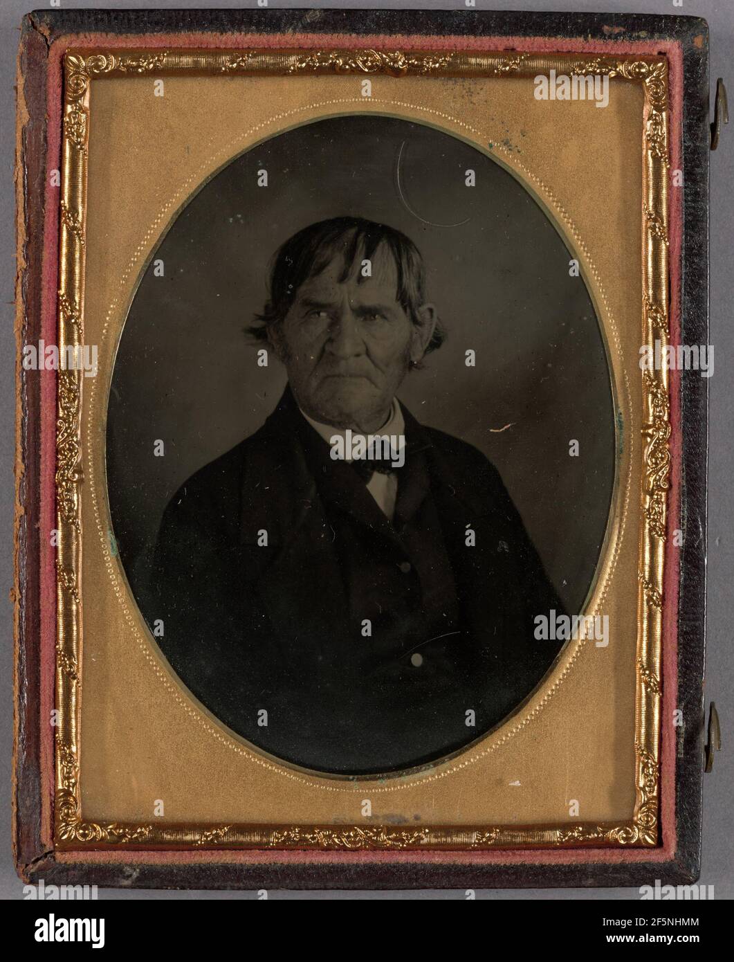 Hair thining hi-res stock photography and images - Alamy