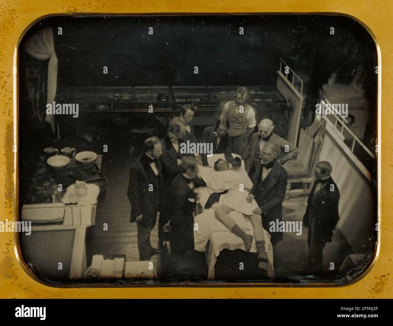 Ether anesthesia hi-res stock photography and images - Alamy