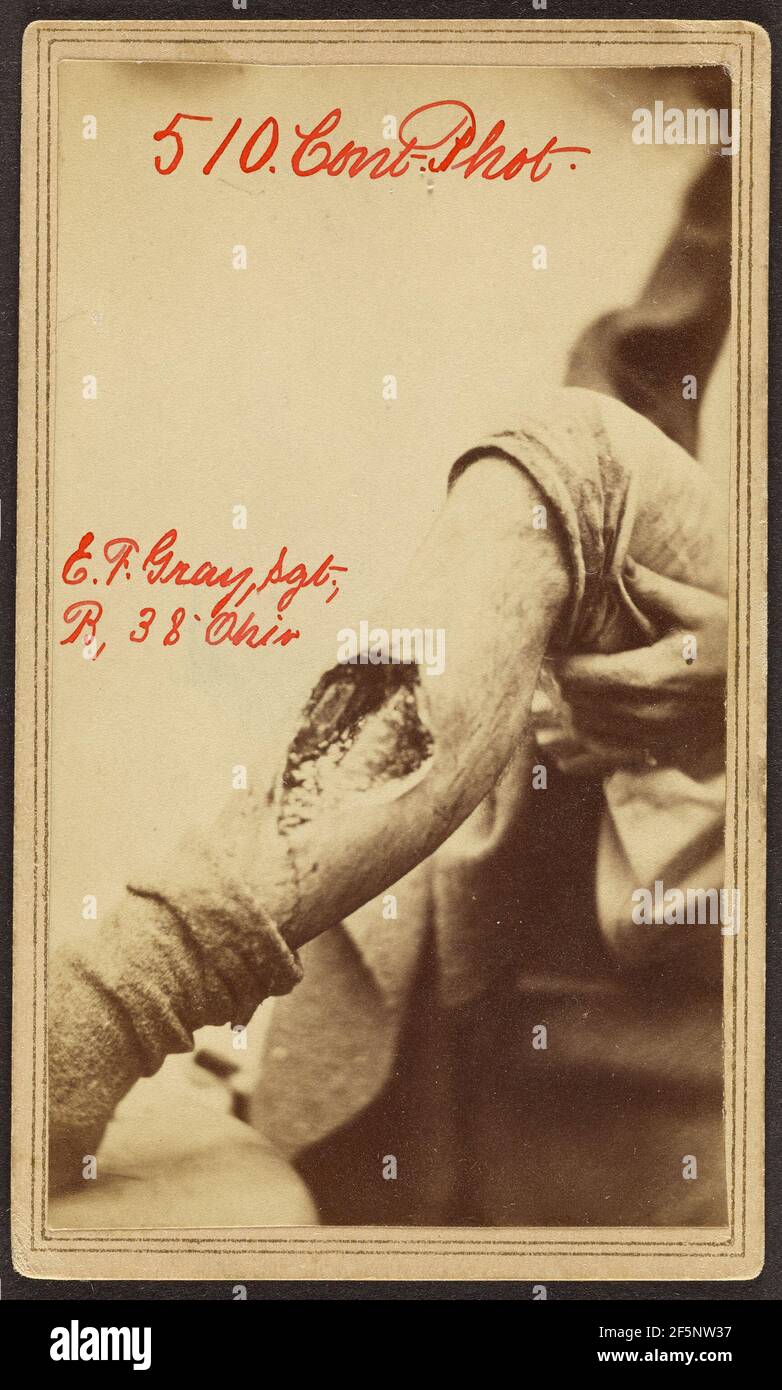 Edward F. Gray. Sergt. Co. B. 38# Ohio. Civil War victim. Attributed to ...