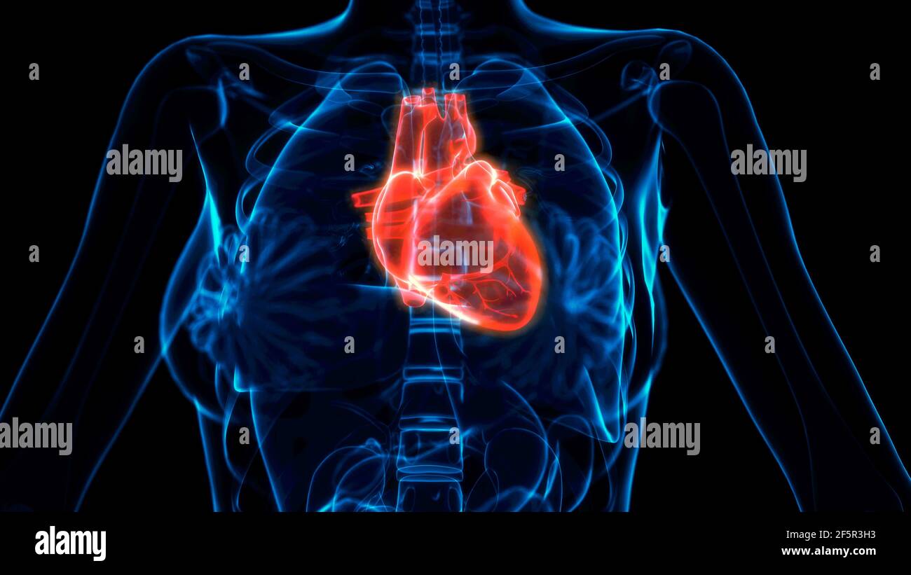 cg medical 3d illustration, human heart illness xray image Stock Photo ...