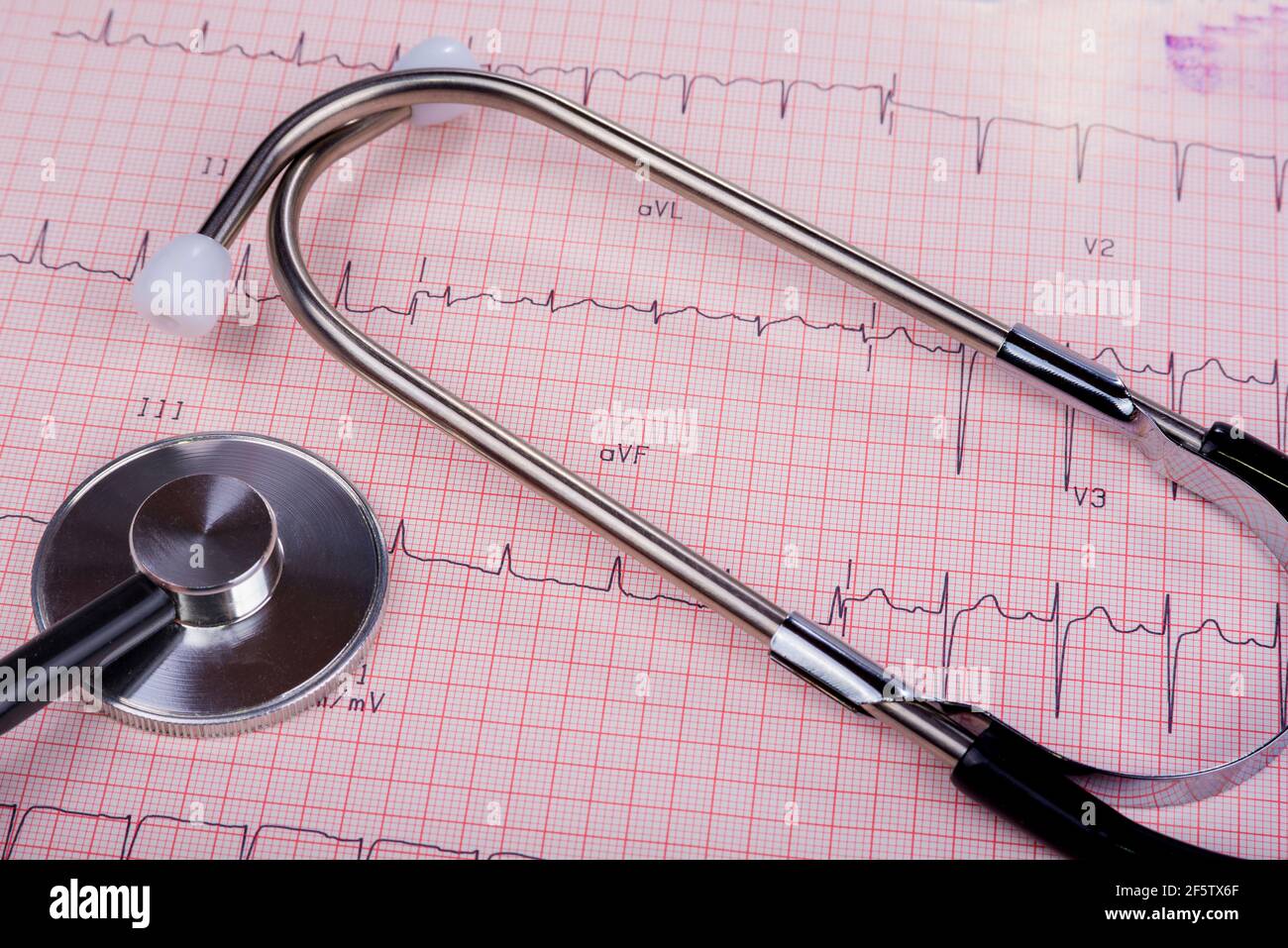 Ecg graph heart diagnose hi-res stock photography and images - Alamy