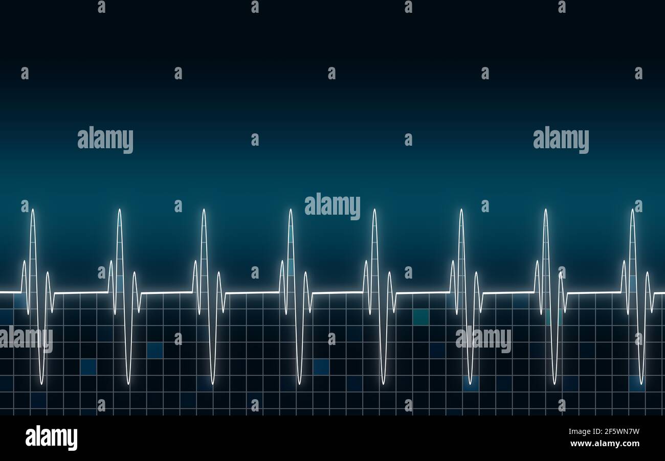 An illustration of a Cardiogram against a dark blue background Stock ...