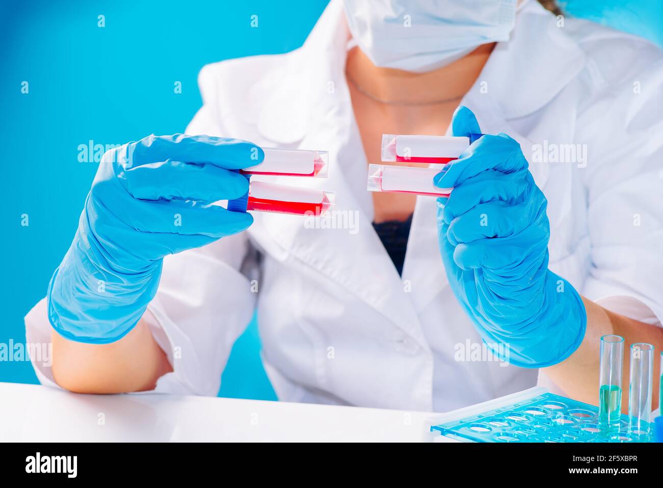 Test tubes in the laboratory close-up. Blood sampling, blood test ...