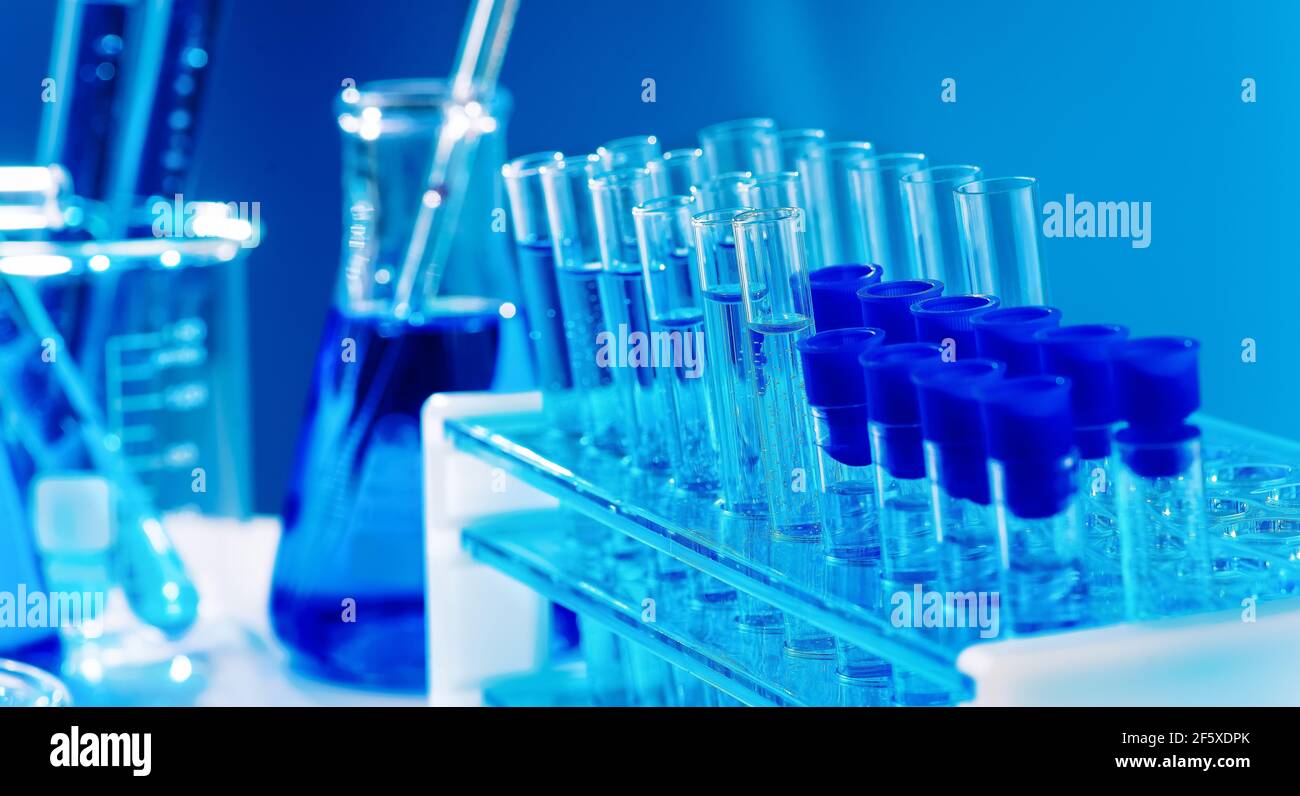 Test tubes in the laboratory close up. Blood sampling, blood test ...