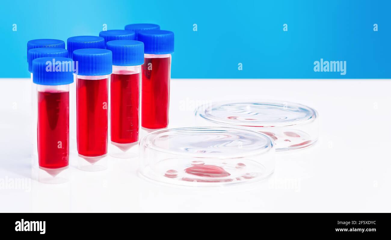 Test tubes in the laboratory close up. Blood sampling, blood test ...