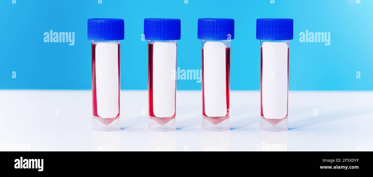 Test tubes in the laboratory close up. Blood sampling, blood test ...