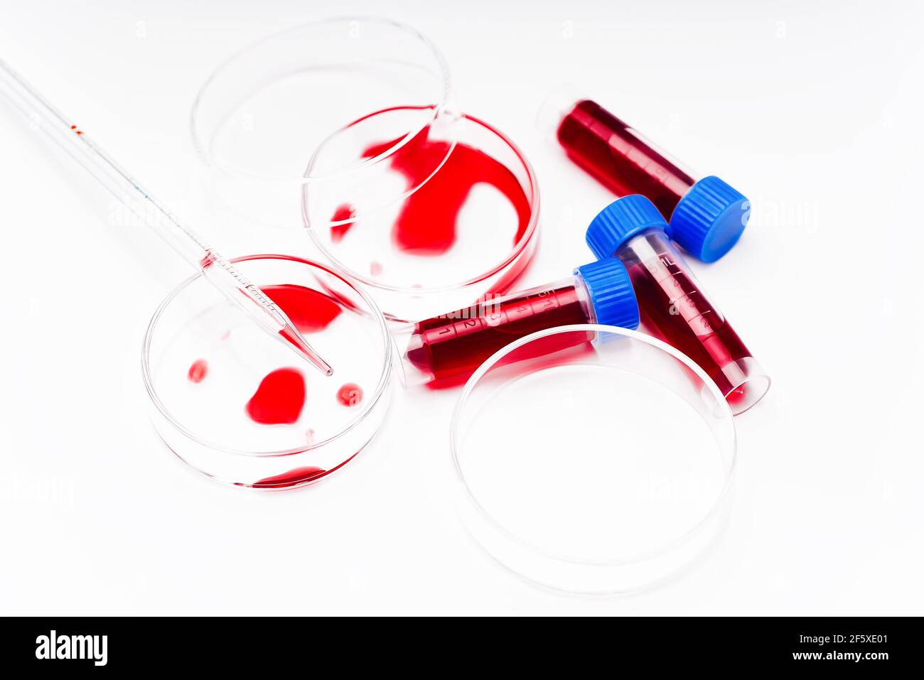 Test tubes in the laboratory close up. Blood sampling, blood test ...