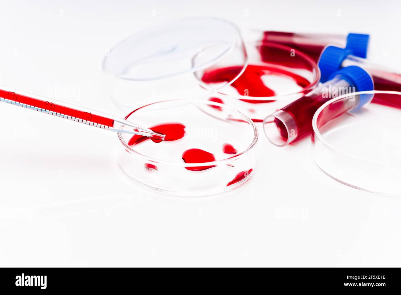 Test tubes in the laboratory close up. Blood sampling, blood test ...
