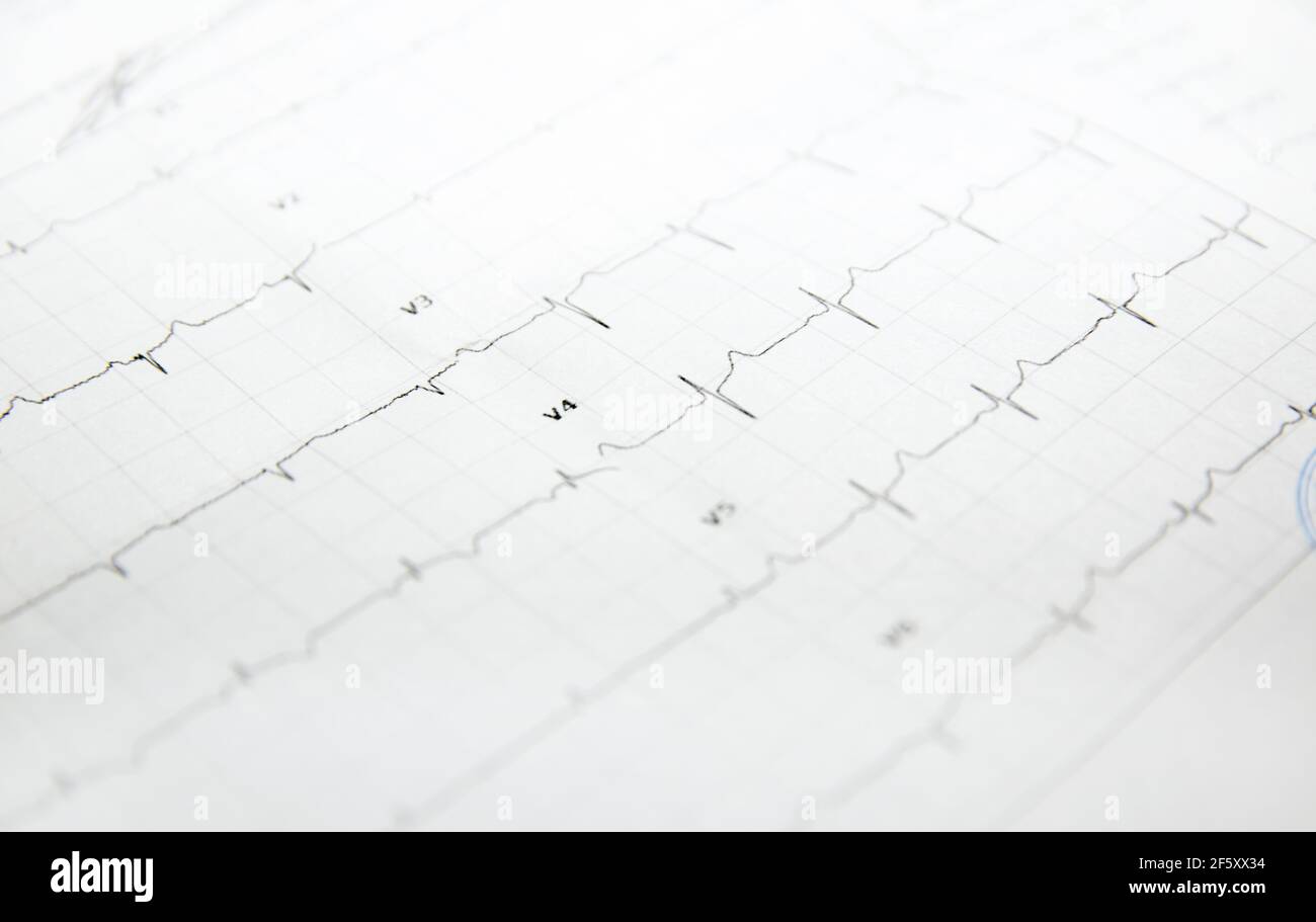 a card with a cardiogram of the heart Stock Photo - Alamy