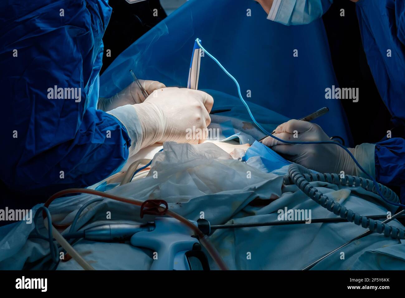 During the operation, the surgeon makes incisions in the skin with an ...