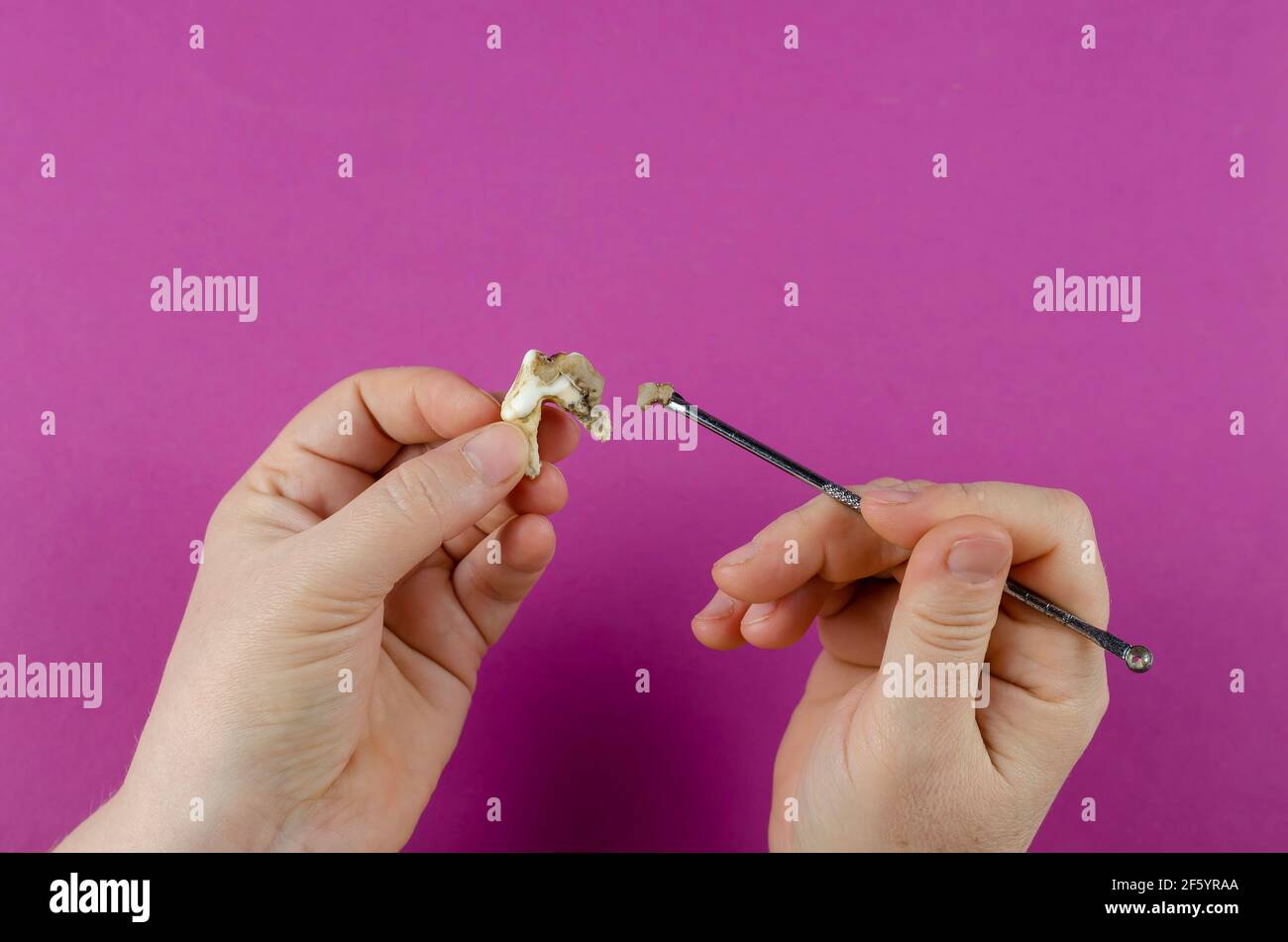 Large animal tooth, female hands and dental scraper on magenta ...