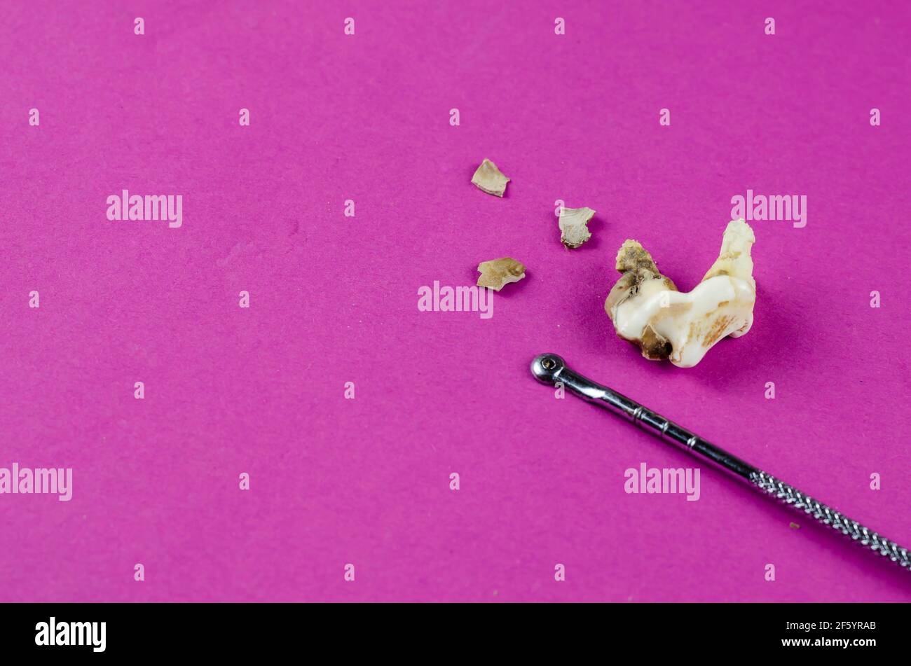 Large animal tooth, plaque and dental scraper on magenta background ...