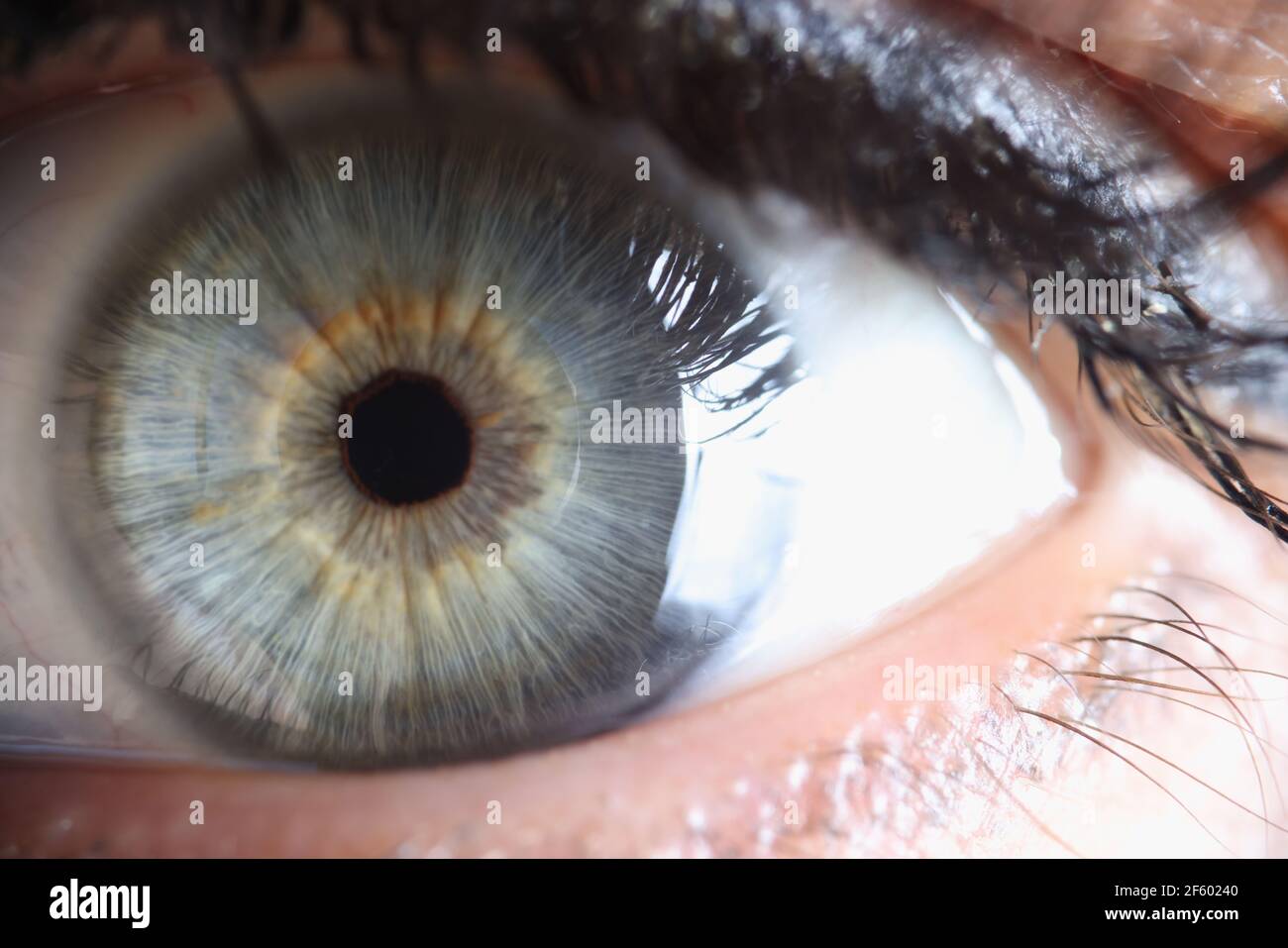 Blue sclera hi-res stock photography and images - Alamy