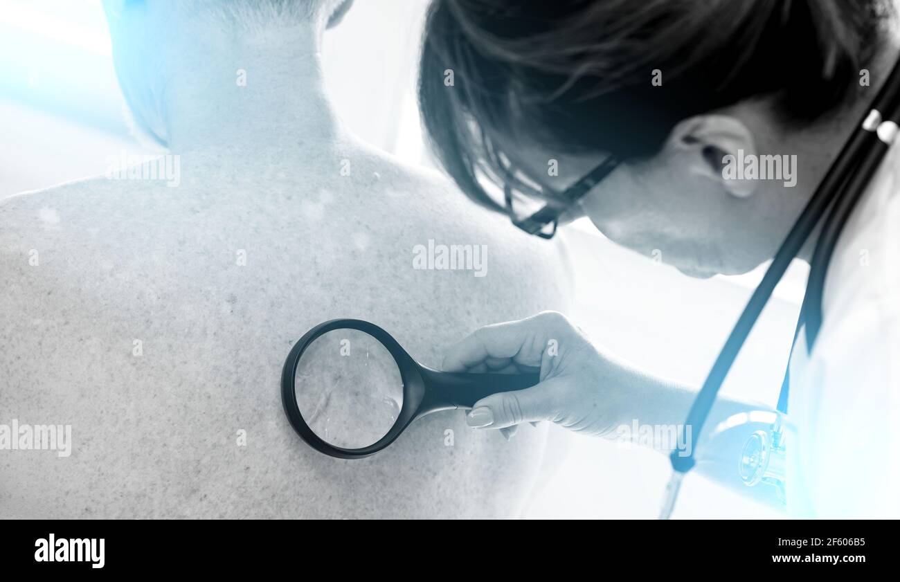 Dermatologist examining the skin on the back of a patient; multiple ...