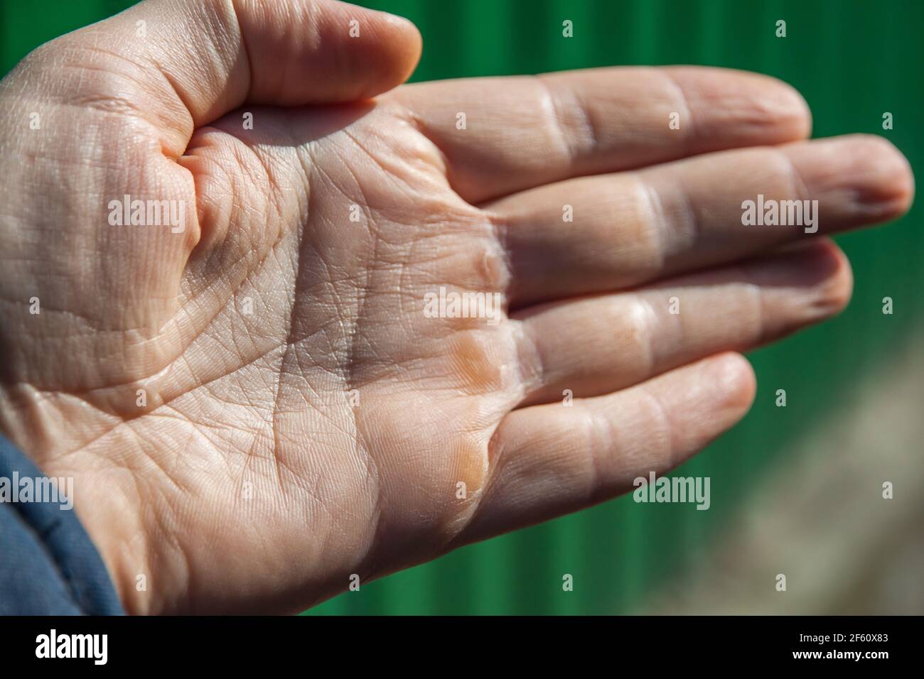 Calloused hands hi-res stock photography and images - Alamy