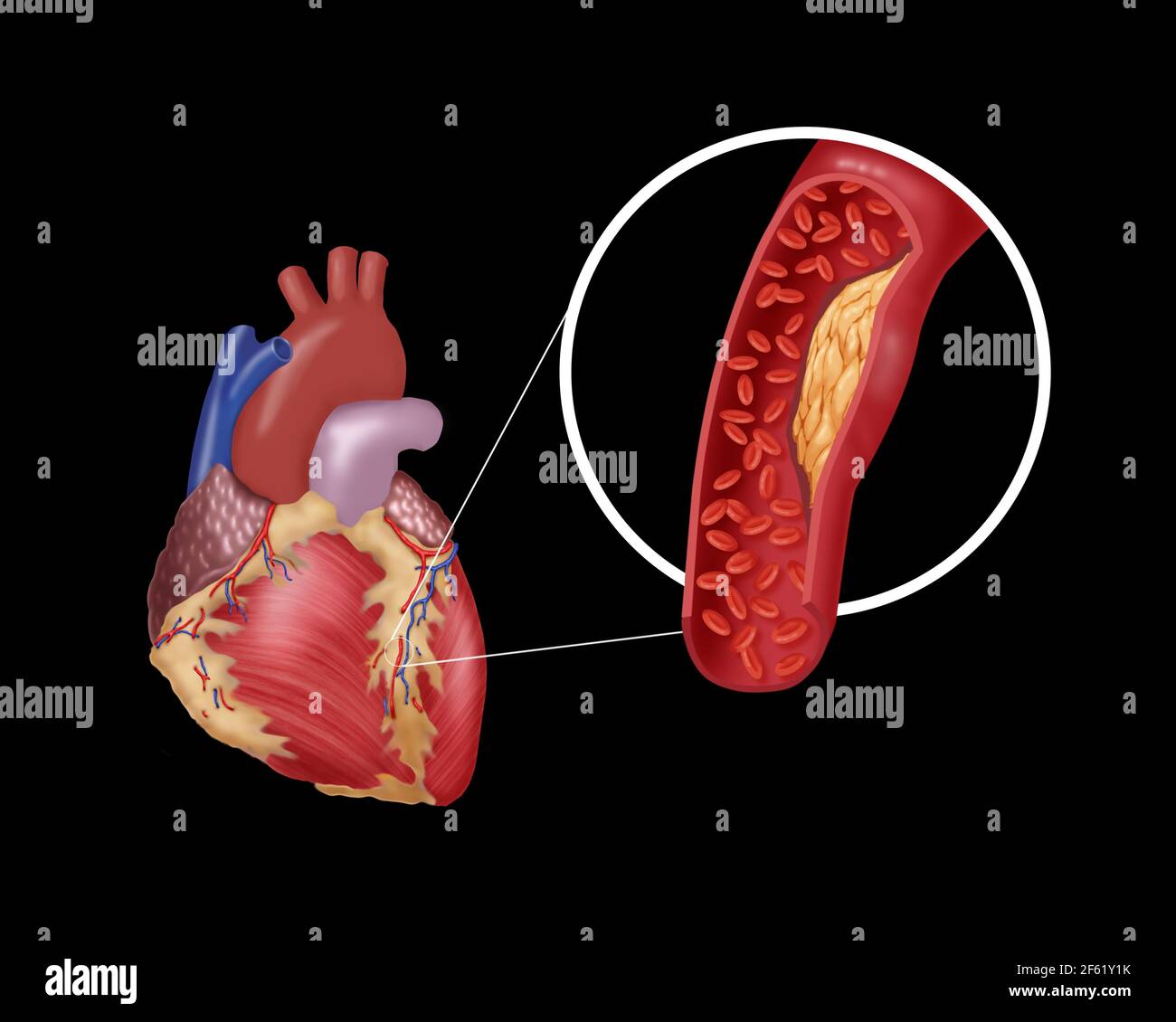 Human balloon hi-res stock photography and images - Alamy