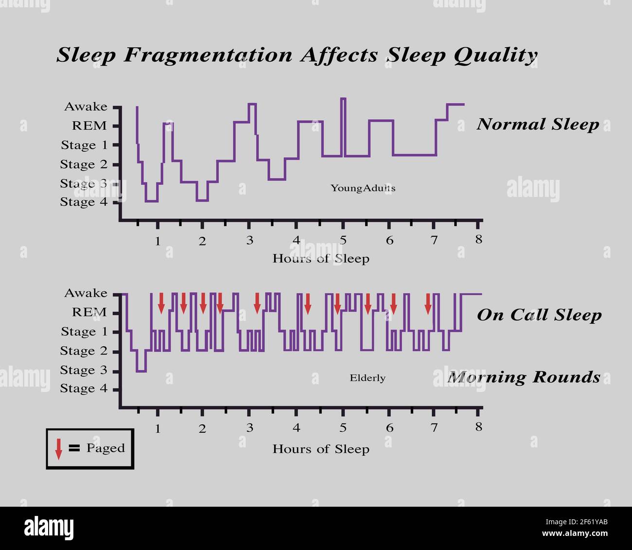 Sleep Fragmentation Affects Sleep Quality, Graph Stock Photo - Alamy