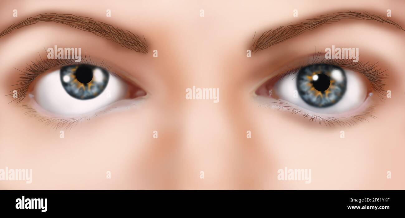 Hypertropia hi-res stock photography and images - Alamy