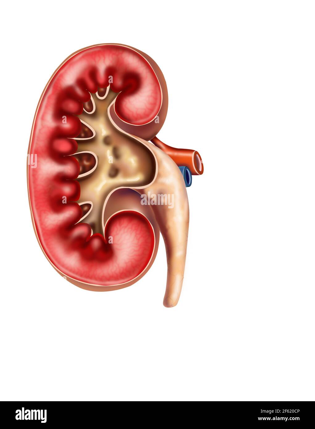 Acute glomerulonephritis hi-res stock photography and images - Alamy