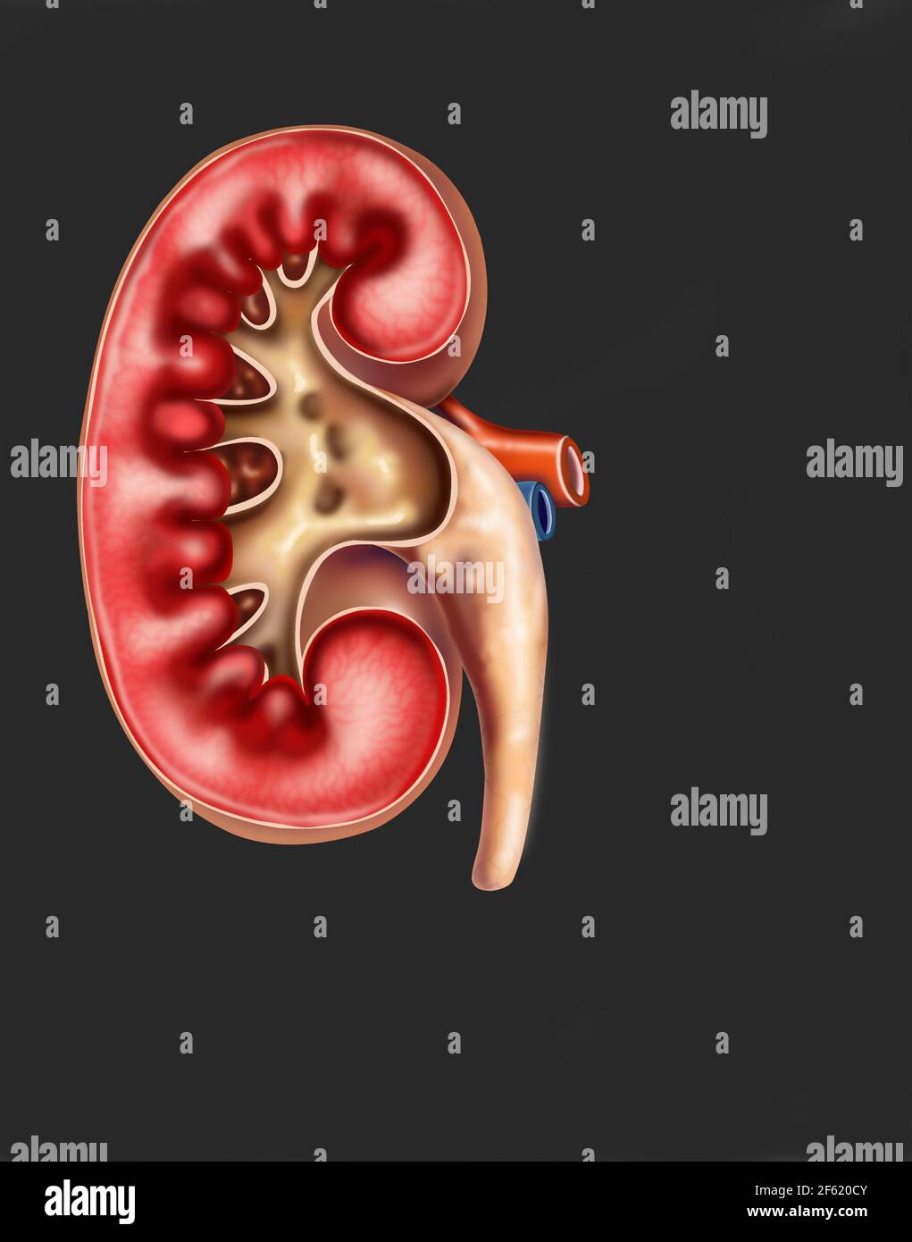Acute nephritis hi-res stock photography and images - Alamy