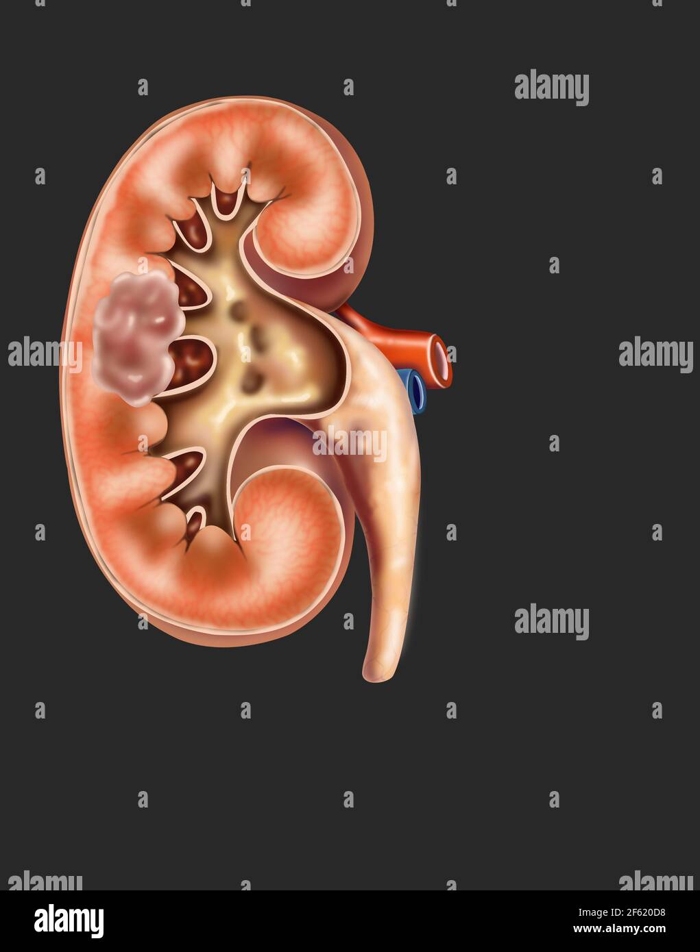 Dissected kidney hi-res stock photography and images - Alamy