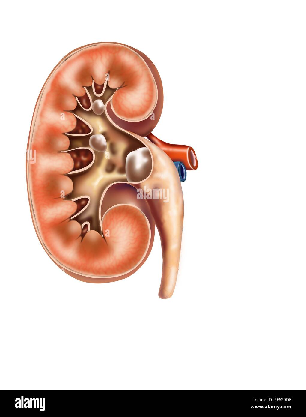 Renal calyces hi-res stock photography and images - Alamy