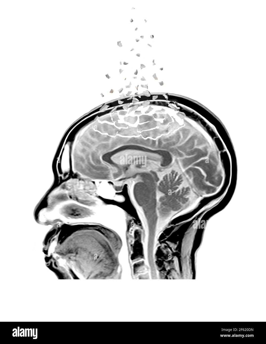 Losing memory Cut Out Stock Images & Pictures - Alamy