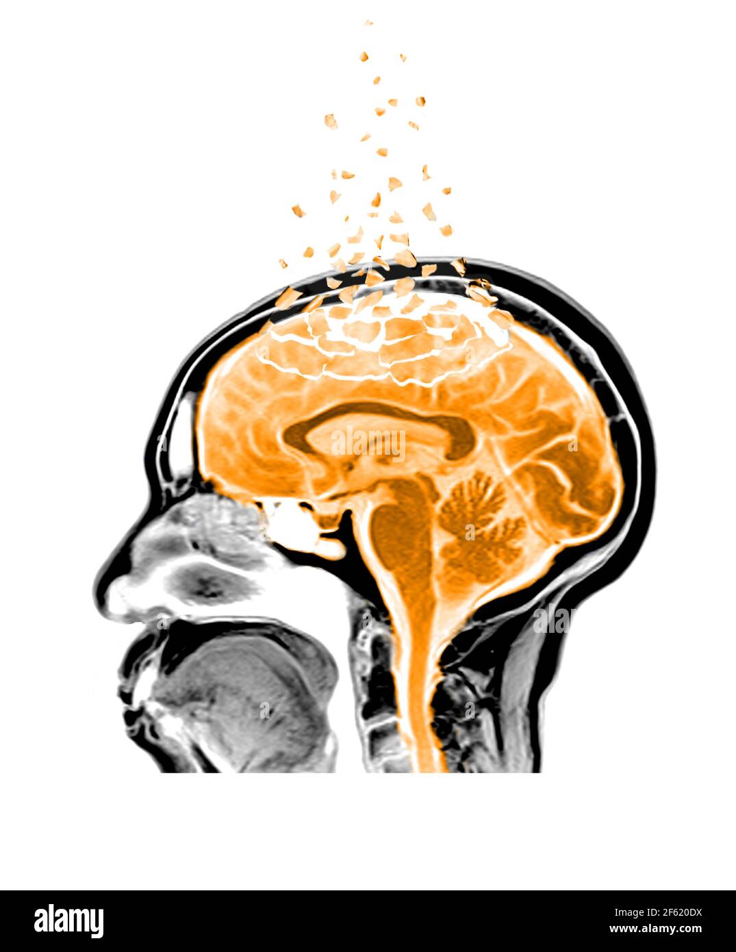 Concept brain memory hi-res stock photography and images - Alamy