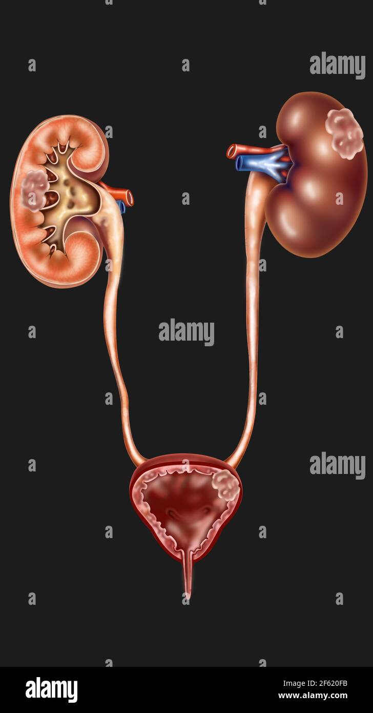Human Kidney Dissection