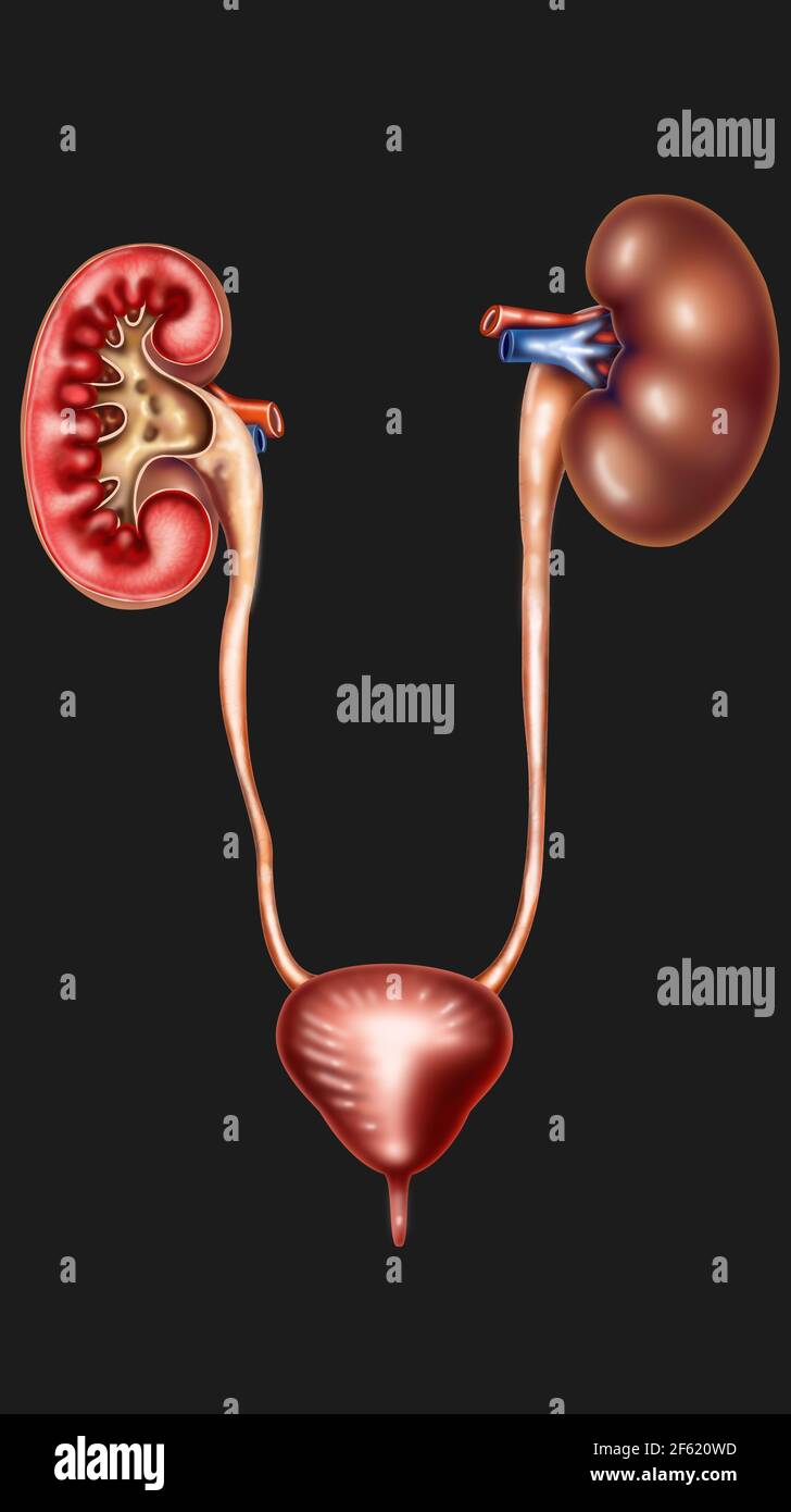 Nephritis hi-res stock photography and images - Alamy