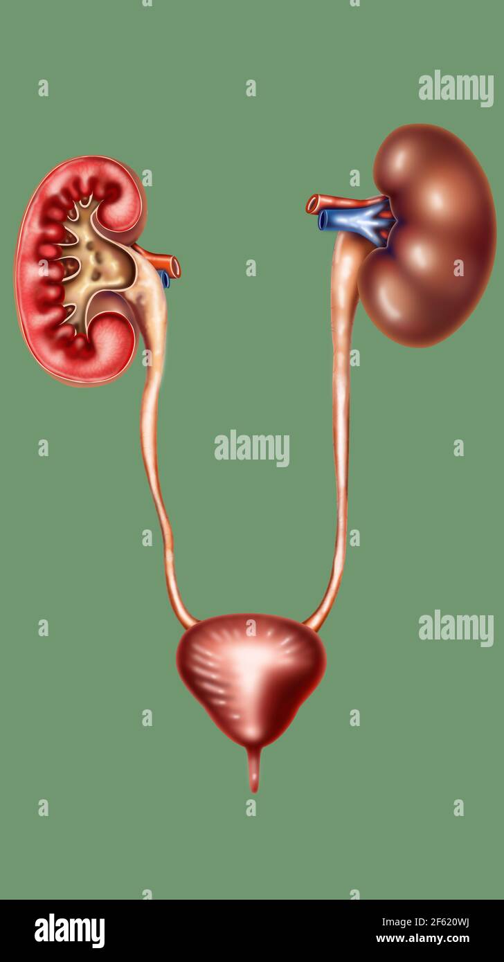 Nephritic Screen